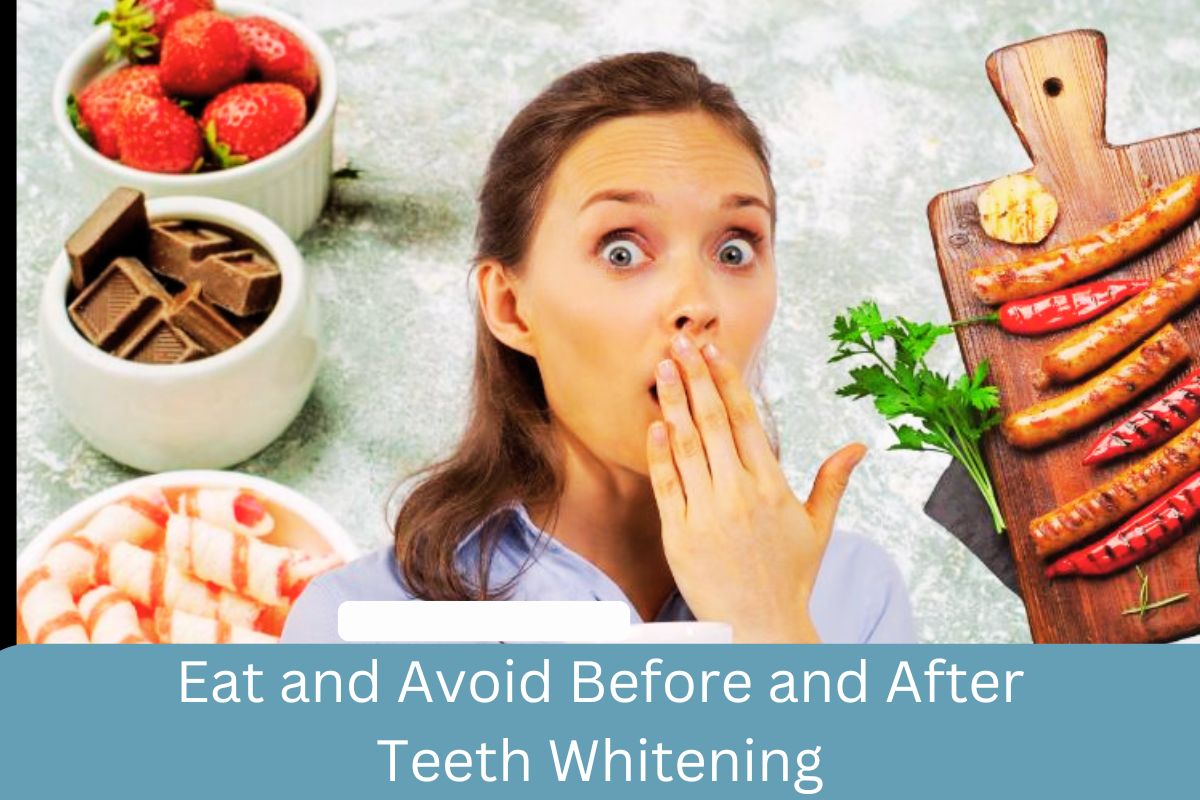 Eat and Avoid Before and After Teeth Whitening